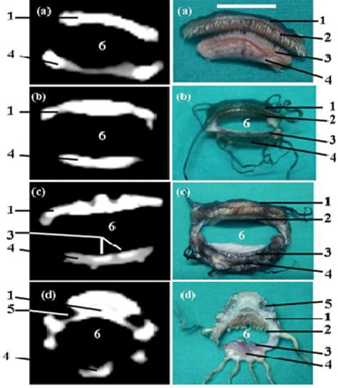 Figure 1 From Evaluation Of Computed Tomography Scanning Of Some Normal