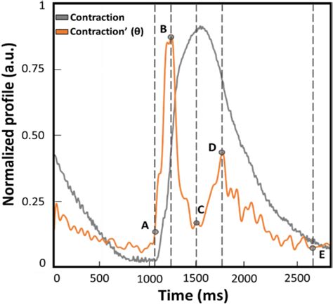 Unlocking Cardiac Motion Assessing Software And Machine Learning For Single Cell And Cardioid