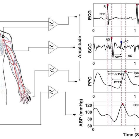 simultaneously recorded cardiological signals and their annotations