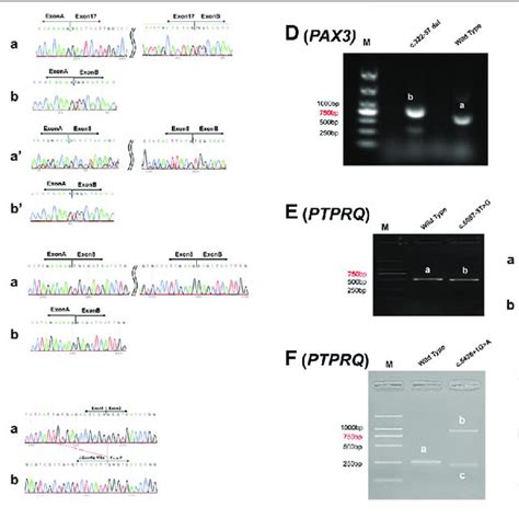 Minigene Assay Analysis Of C16163a T And C580g A In Eya4 A