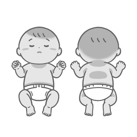 あせもが出やすい場所を示すイラスト🎨【フリー素材】｜看護roo カンゴルー