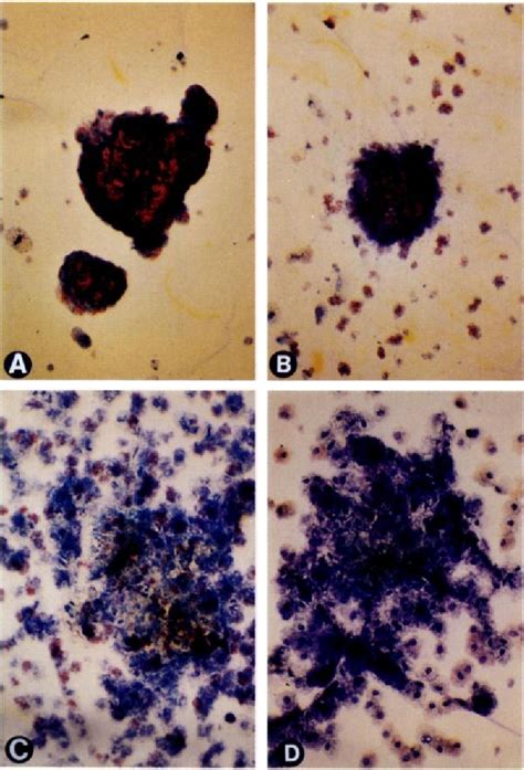 Figure 1 From Augmentation Of Neutrophilic Granulocyte Progenitors In