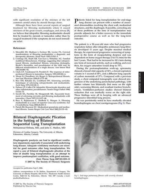 Bilateral Diaphragm Plication Prior To Transplantation Pdf