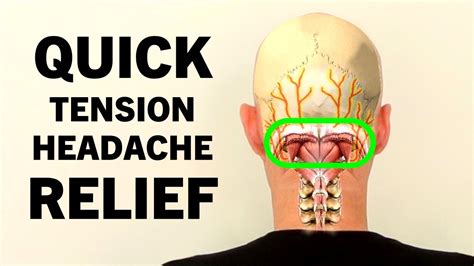 Tension Headache Exercises Stress Headache Relief In 4 Minutes Youtube