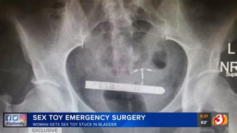 Une Jeune Femme Doit être Hospitalisée Durgences Après Que Son Sex Toy