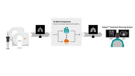 Autocontouring In Radiation Therapy Siemens Healthineers Siemens Healthineers Usa