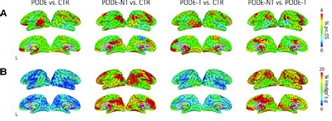 Heatmaps Of Functional Connectivity Alterations A Qualitatively Download Scientific Diagram