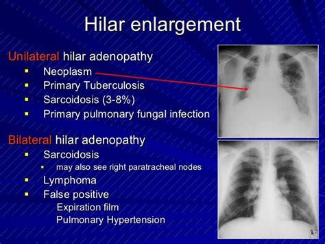 Chest Radiology In Intensive Care
