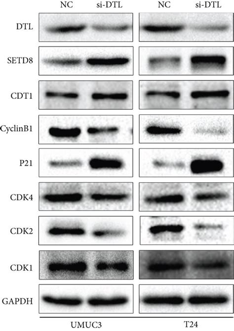 Depletion Of DTL Suppresses BCa Cell Proliferation And Restrains G2