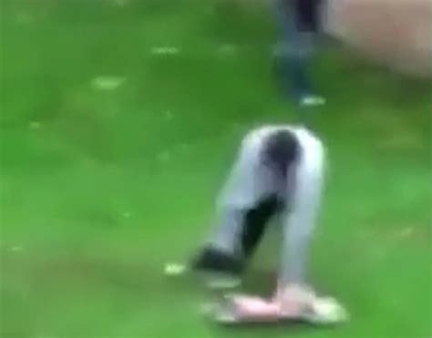 Man Beaten With False Leg In Video Lost Limbs After Being Hit By Train