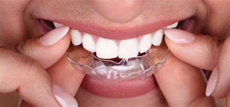 Fix Overbite With Clear Aligners Laster Orthodontics