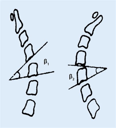 8 Diagram Showing Measurement Of The Angular Displacement Of The