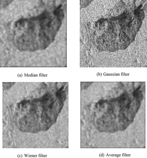 Restored Images Corrupted With Speckle Noise Using A Median Filter B Download Scientific