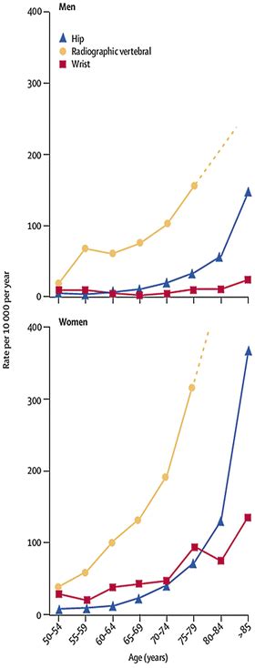 Osteoporosis Pathophysiology And Epidemiology Oncohema Key