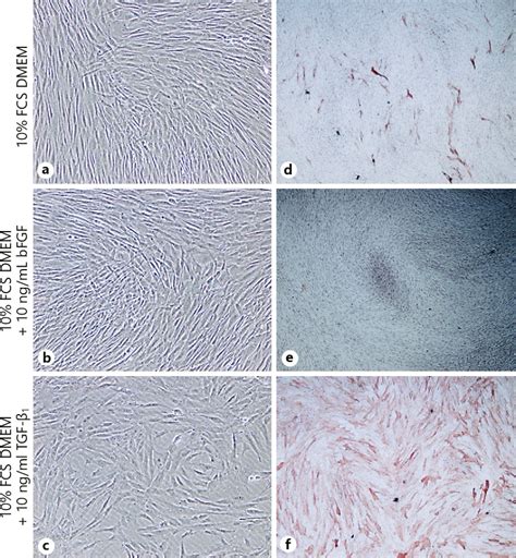 Table From Basic Fibroblast Growth Factor Influences Epidermal