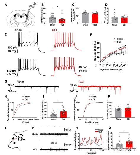 Neurobiol Dis︱郑州大学杨建军课题组揭示外侧下丘脑 外侧缰核神经环路在神经病理性疼痛中的重要作用 知乎