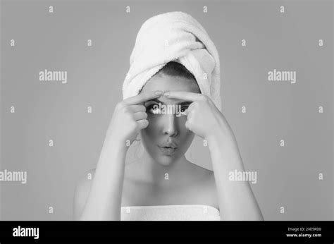 Woman Squeeze Out Pimples On Forehead Acne And Pimple On Skin