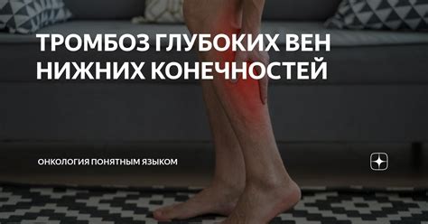 ТРОМБОЗ ГЛУБОКИХ ВЕН НИЖНИХ КОНЕЧНОСТЕЙ Онкология понятным языком