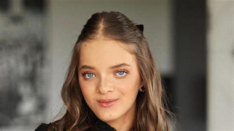 Foto 1 mês após cirurgia Rafaella Justus exibe nariz em nova foto e