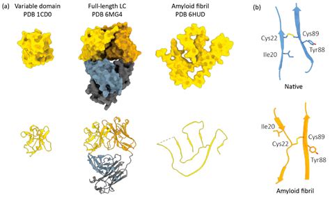 What Is Lambda Light Chain Amyloidosis