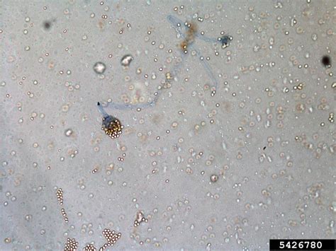 Mucor Under Microscope