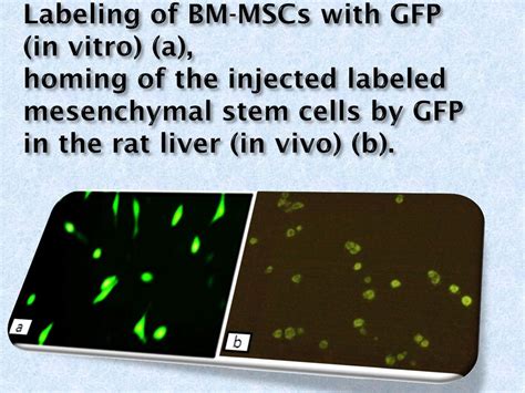 Comparison Of Treatment Efficiency Of Intravenous And Intrasplenic Injection Of The Bm Derived