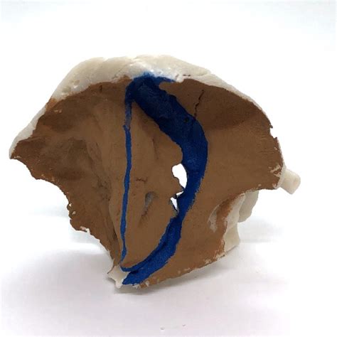 3d Printed Temporal Bone Models Kezlex