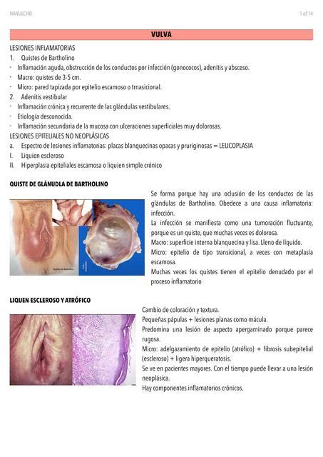 Femenino II Vulva y Útero HANULCHO Victoria Enciso uDocz