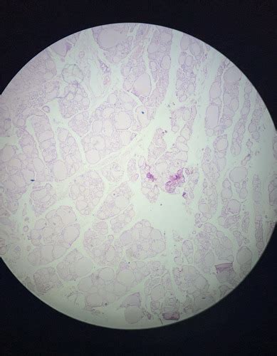Ap Lab Practical Microscope Flashcards Quizlet
