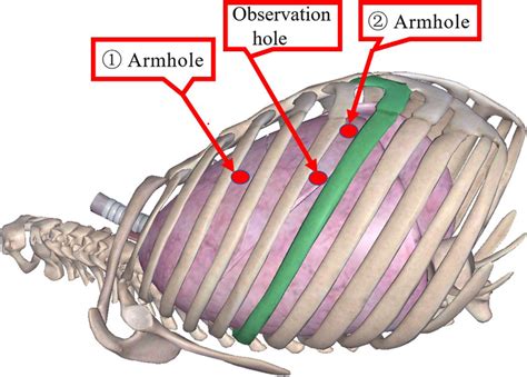 Hole Layout Of Lateral Thoracic Approach Download Scientific Diagram