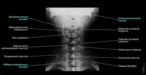 Позвоночник рентгенограммы нормальная анатомия E Anatomy