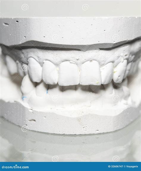 Dental Gypsum Model Mould Of Teeth In Plaster Stock Image Image Of Care Dentist