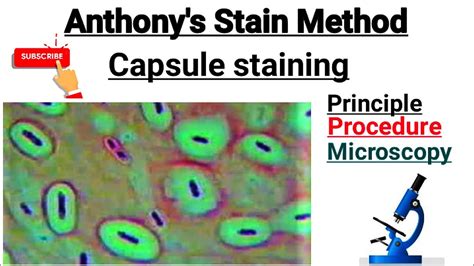 Why Is Heat Not Used In Capsule Staining At Joy Herman Blog