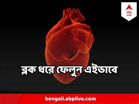 Heart Blockage Can Cause Heart Attack Know The Symptoms What Tests