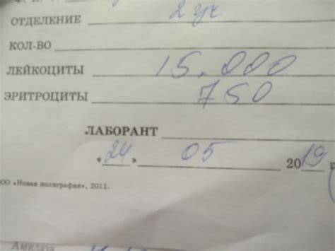 Понижены лейкоциты в крови От чего могут быть понижены лейкоциты в