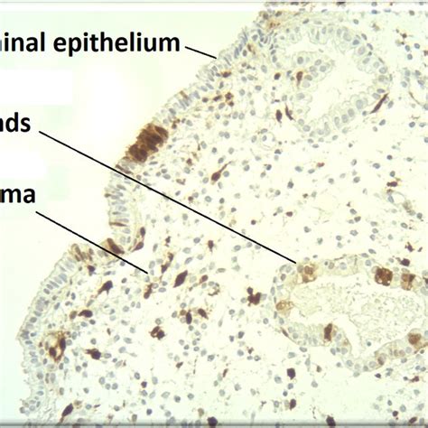 Pdf Presence Of P16 Positive Senescent Cells In Human Endometrium
