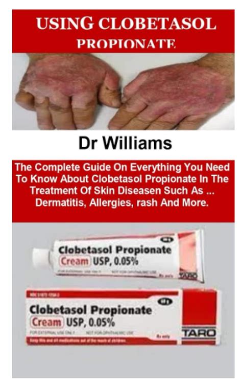 Using Clobetasol Propionate The Complete Guide On Everything You Need