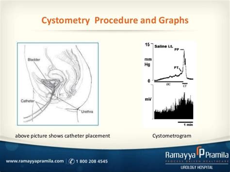 Urodynamics Uroflowmetry