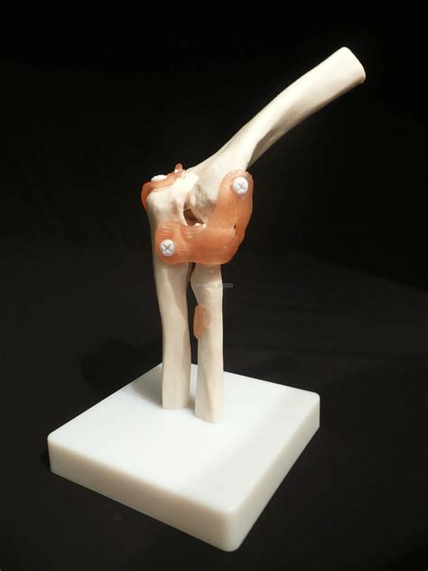 Human Life Size Elbow Joint Anatomical Model In Trauma Anatomy Skeleton