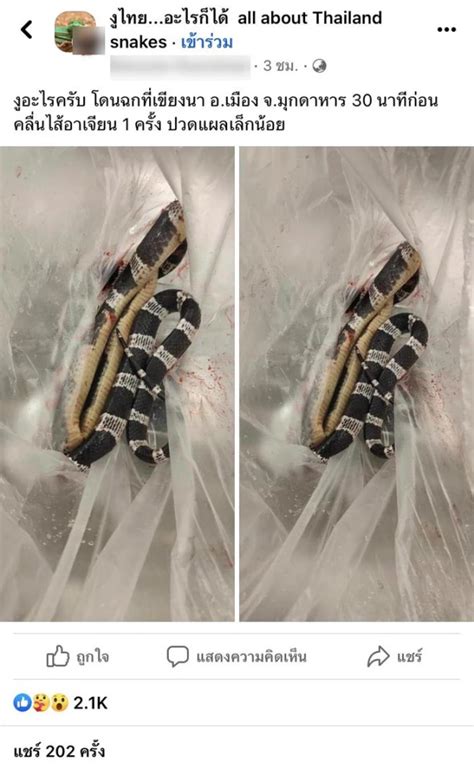 สาวโดนงูฉกในนา ทำเอาหมอสงสัยคืองูอะไร ชาวเน็ตเห็นแล้วตกใจแรง