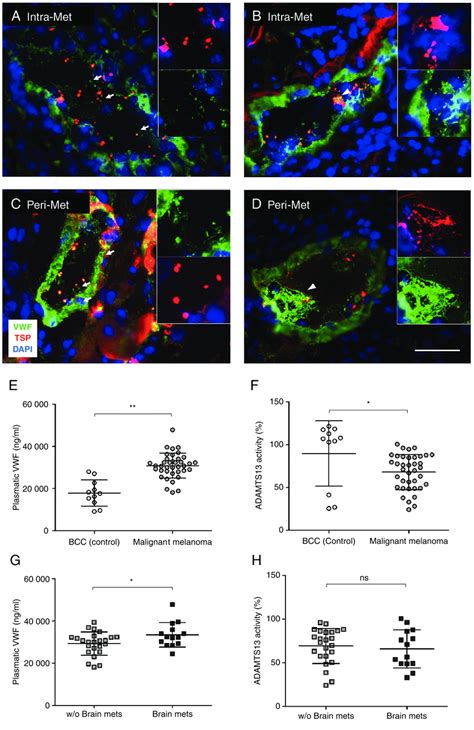 Luminal Vwf Fibers And Platelet Aggregates Are Detected In The Brain