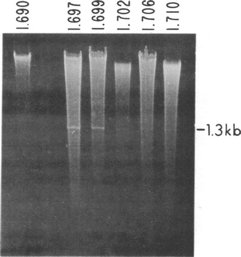 Agarose Gel Electrophoresis Of Eco Rl Digested Fractions Of Mouse