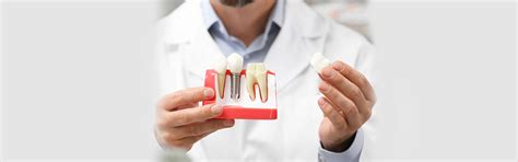 Sugar Land Dental Implants Smile With Confidence