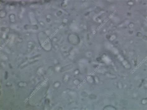 Gut Bacteria Light Microscopy Stock Video Clip K004 9036 Science