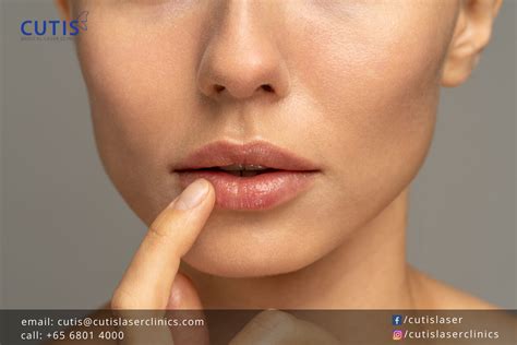 Got Dry Lips Heres A Lip Care Routine For You