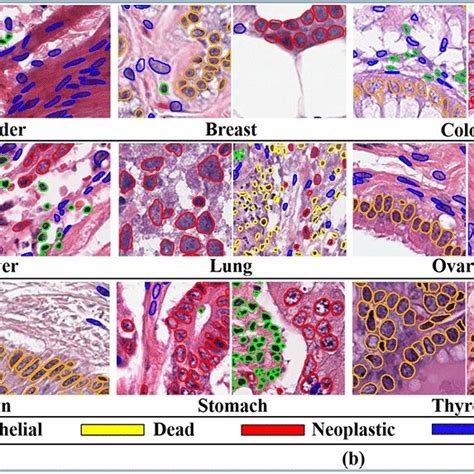 Transformer Based Architectures For Histopathological Image Analysis