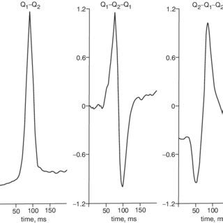 QRS Complex Shapes Three Different State Sequences Medical Download Scientific Diagram