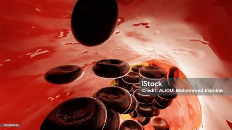 Hemostasis 혈관의 적혈구와 혈소판 상처 치유 과정의 기본 단계 3d 일러스트레이션 혈우병에 대한 스톡 사진 및 기타