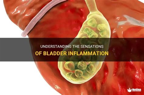 Understanding The Sensations Of Bladder Inflammation Medshun