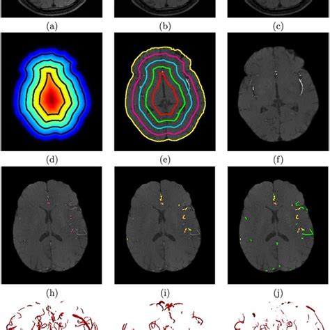 Sample Output Of The Local Adaptive Segmentation Algorithm A